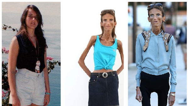 The Heartbreaking Story of Valeria Levitin: A Cautionary Tale About the Dangers of Body Image ...